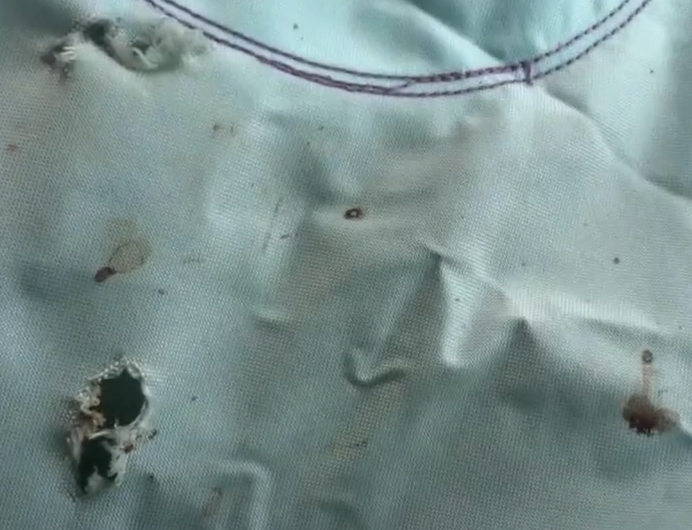 Takata Eye Injury & Blindness Lawsuit Lawyer | Exploding Airbag